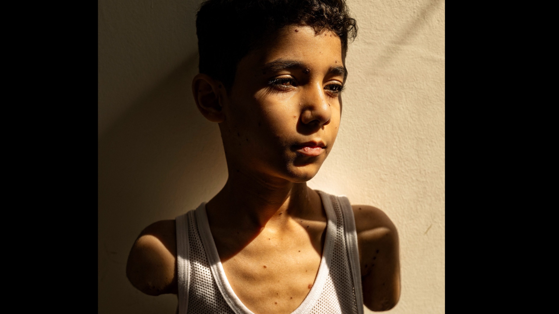 La guerra di Gaza, le vittime più indifese: la Foto dell'Anno 2025 ...